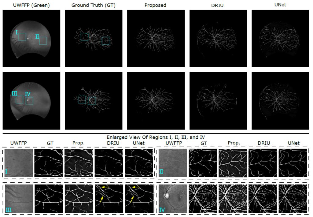 Deep Retinal Vessel Segmentation For Ultra-Widefield Fundus Photography ...